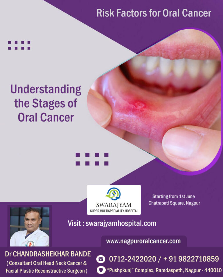 "Understanding the Stages of Oral Cancer"